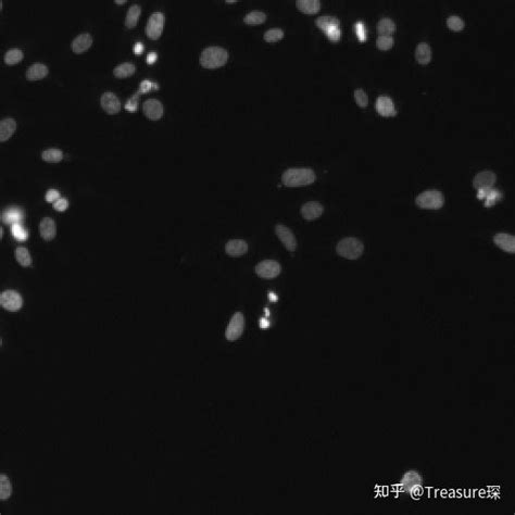 imagej实用教程——stardist批量细胞计数 案例分析篇 知乎