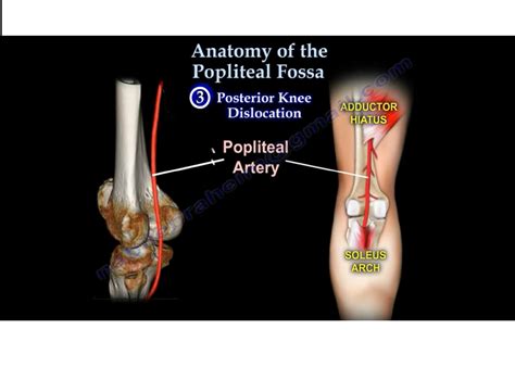 Popliteal Fossa Diagram