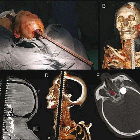 Mohammad Mansour On Linkedin Well Yes He Survived