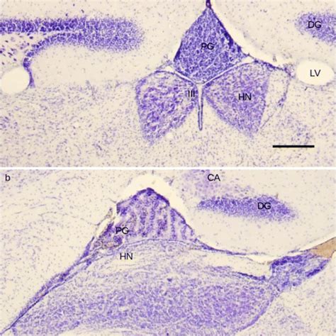 Pinealocyte Of Population I Magnification 14 500× Cd Ciliary Download Scientific Diagram