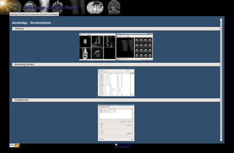 Postdicom Free Dicom Viewer For Windows Linux Macos Sugggest