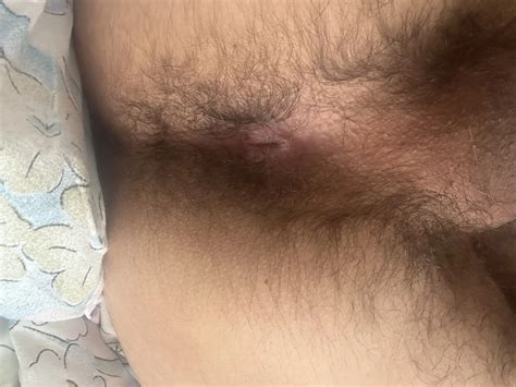 Hairy Hole 8 Nude Pics XHamster Hairy Hole 8 Nude Pics XHamster