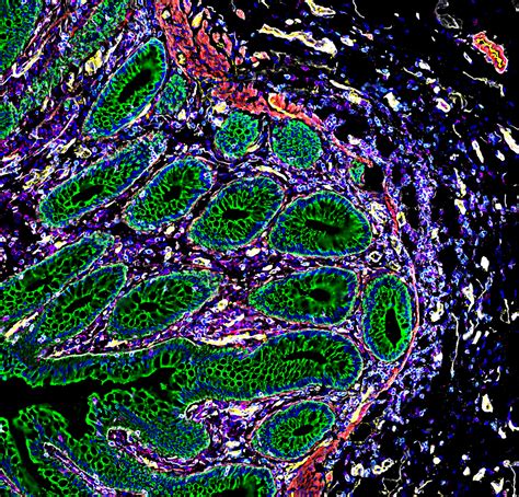 First Spatial Map Of The Intestine At The Single Cell Level