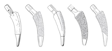 Specialist For Short Stem Tha Prof Kutzner