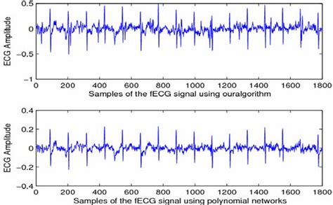The Fecg Signal Is Extracted By Using Two Different Methods Download Scientific Diagram