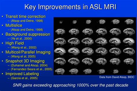 PPT Physiologic Basis Of FMRI Signals Focus On Perfusion MRI PowerPoint Presentation ID