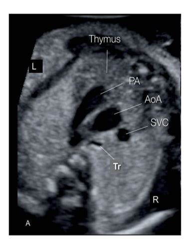 Important Flashcards Quizlet