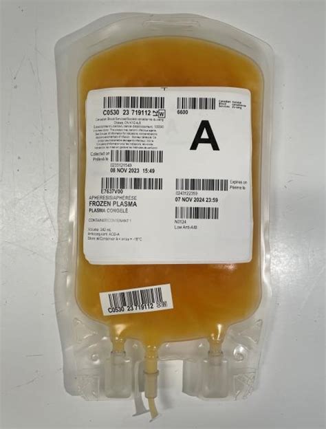 Plasma Professional Education