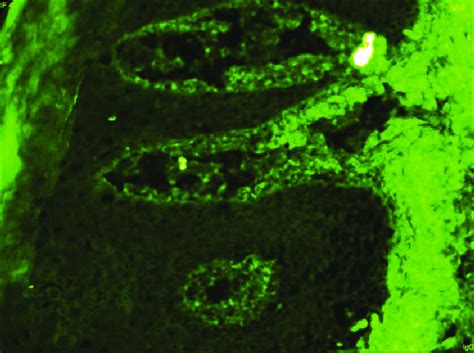 Deposition Of Igg In A Linear Granular And Discontinuous Pattern Along Download Scientific