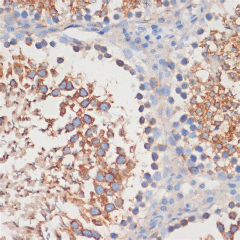 Cdc42 Polyclonal Antibody Epigentek