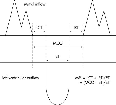 Schema For Measurement Of Doppler Intervals Myocardial Performance
