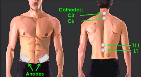Figure 1 From Neural Substrates Of Transcutaneous Spinal Cord