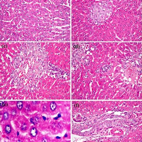 Histological Liver Section From Control Group Showing A Normal