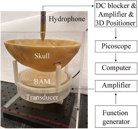 Binary Acoustic Metasurfaces For Dynamic Focusing Of Transcranial