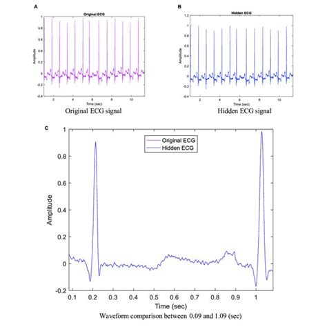Comparison Between Original Electrocardiogram Ecg Signal And Hidden