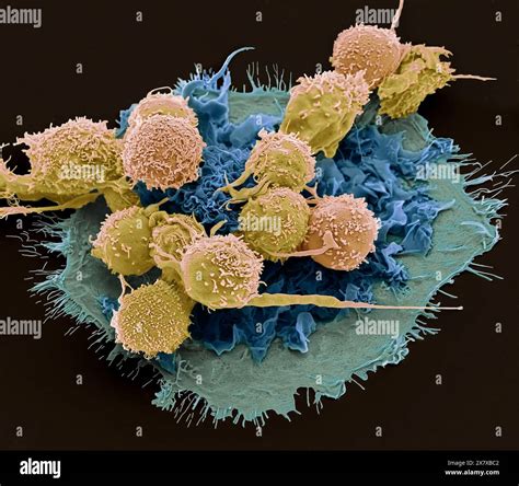 Macrophage And T Cells Coloured Scanning Electron Micrograph Sem