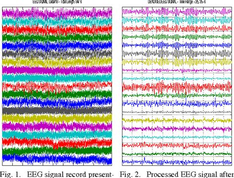 Figure From Multi Channel EEG Signal Segmentation And Feature Extraction Semantic Scholar