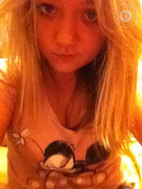 New French Porn Tube Strapon Porn Video Define Addisons Disease