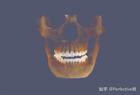 Vtkjs之renderwindow渲染图像展示 知乎 Vtkjs之renderwindow渲染图像展示 知乎