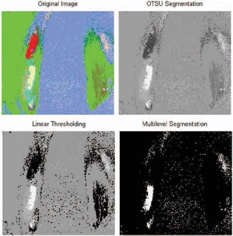 Figure 1 From A Noninvasive Cancer Detection Using Hyperspectral Images