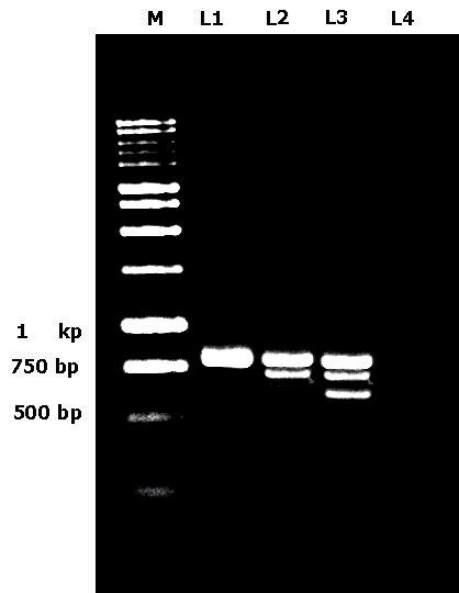 Detection Of Pvy Pvx And Plrv By Rt Pcr And Multiplex Rt Pcr From