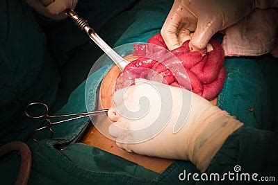 Identify Appendix Stock Photo Image