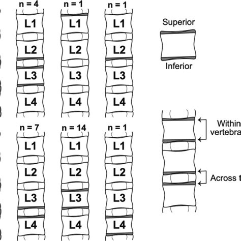 Origin Of The Vertebral Endplate Specimens Used In This Study With
