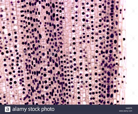 Mitosis Micrograph High Resolution Stock Photography And Images Alamy