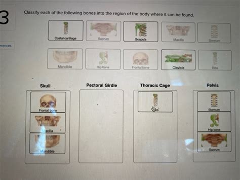 solved classify each of the following bones into the region