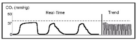 6 Lab Etco2 Waveforms With Pics Flashcards Quizlet