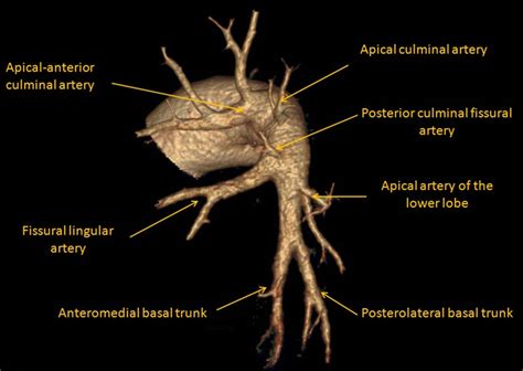 Pulmonary Artery Segmental Anatomy