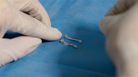 Video Author Spotlight An Economic And Efficient Method For Quantitative Evaluation Of Bone