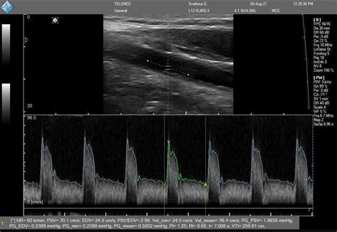 Telemed Ultrasound Home Telemed Ultrasound Home