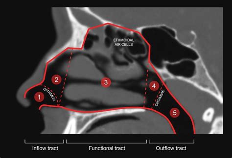 1 Sagittal Cross Section From A Ct Scan Showing The Structural Elements