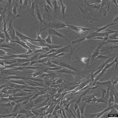 Mrc 5 Cell Line Human Fetal Lung Fibroblasts In Viral Research