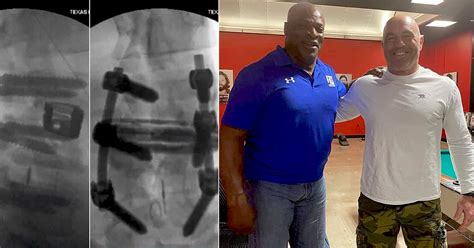 Ronnie Coleman Talks To Joe Rogan About Getting Insane 13 Surgeries