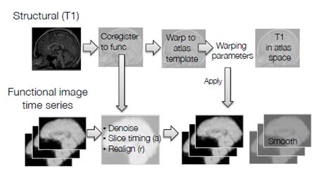 fMRI NoteModule Pre processing of fMRI data Part 知乎