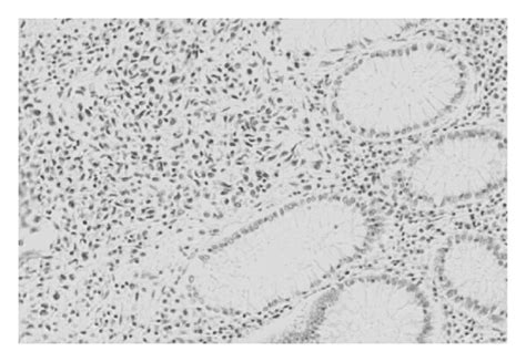 Nucleus Segmentation Of H Stain Images Based On Three Stain Separation