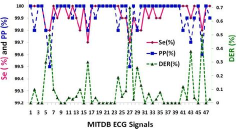 Performance Of The Proposed Qrs Detector In Terms Of Se Pp And Der