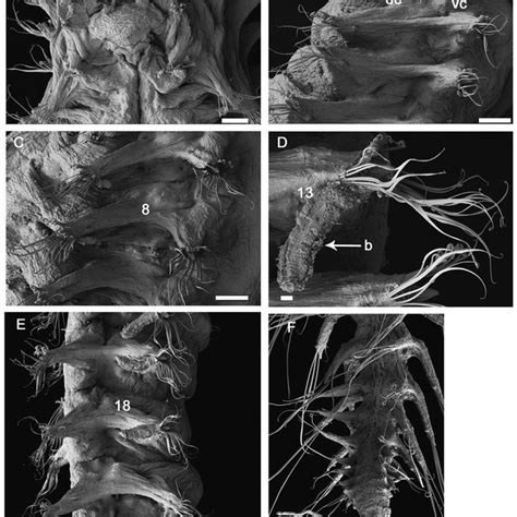 Nephtys Bangladeshi N Sp Sem Photographs A Dorsal View Of Anterior