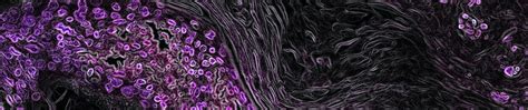 Breast Cancer Cell Segmentation Kaggle