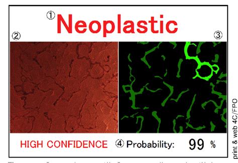 Figure 1 From Characterization Of Colorectal Lesions Using A Computer Aided Diagnostic System