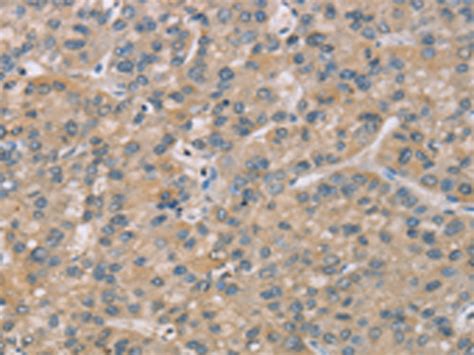 兔抗zbtb3多克隆抗体anti Zbtb3 Rabbit Polyclonal Antibody 生命科学产品与技术服务 生工生物工程