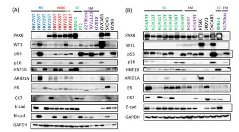 Expression Of Ovarian Cancer Several Histotype Specific Markers In