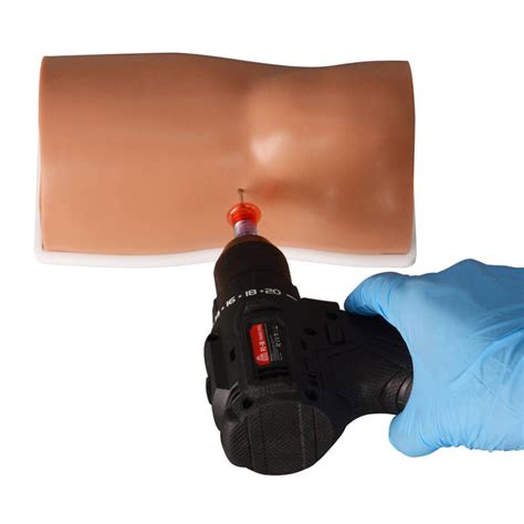 Preferred Sites For Intraosseous Access Injection Needle Insertion Ultrassist