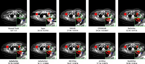 Figure 1 From Coupling Model And Data Driven Networks For Ct Metal