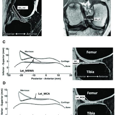Anatomic Measurements Obtained From Segmentation Of Magnetic Resonance Download Scientific