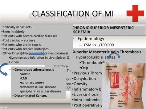 Mesenteric Ischemia Presentation By Dr Noshi Capital Hospital Islama…