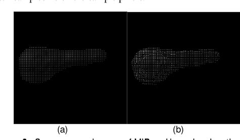 Figure 8 From Using Multiscale Medial Models To Guide Volume Visualization Semantic Scholar