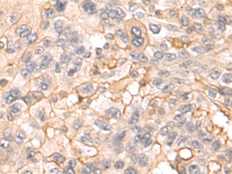 兔抗cgas多克隆抗体anti Cgas Rabbit Polyclonal Antibody 生命科学产品与技术服务 生工生物工程上海
